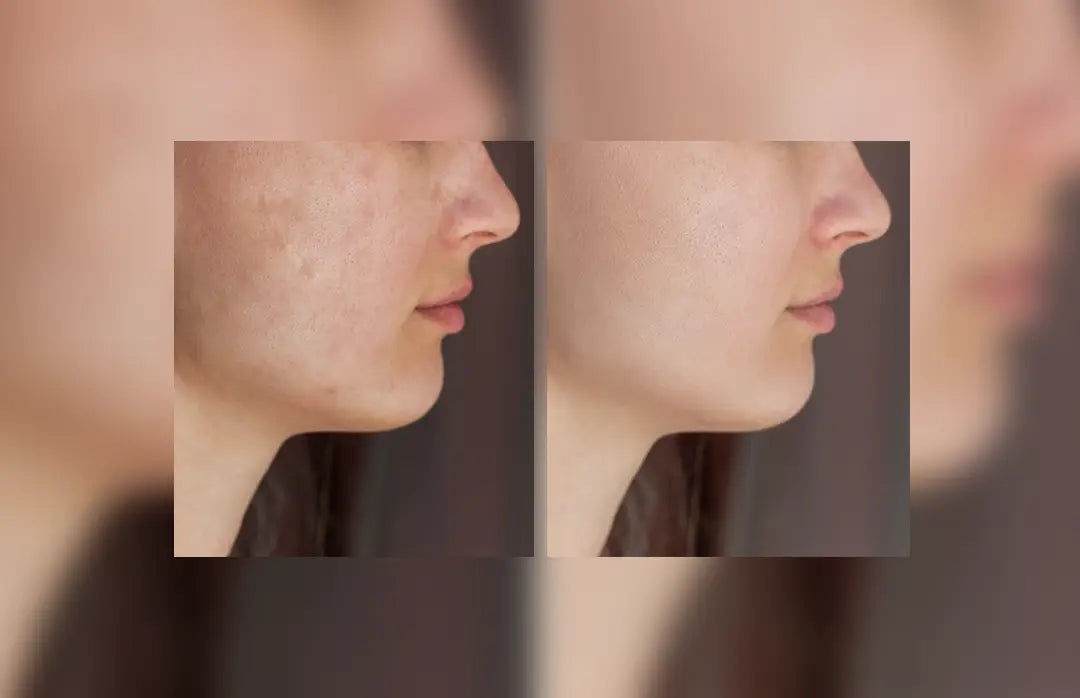 Glutathione Tablets Before and After: Results to Expect