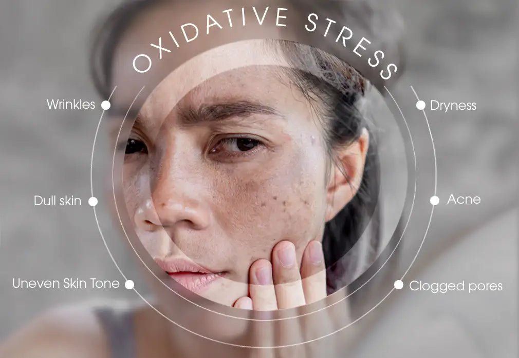 Oxidative Stress, its effects on Skin, and how to tackle it? - Glutone